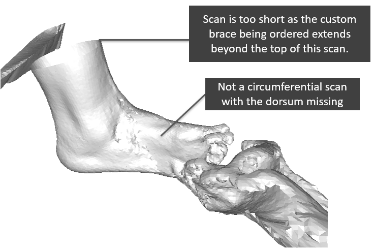 OHI1Scan Troubleshooting Support