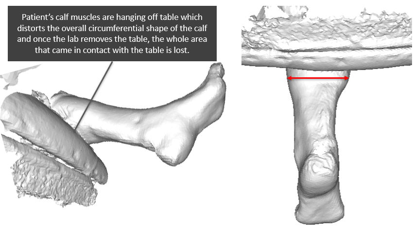 OHI1Scan Troubleshooting Support