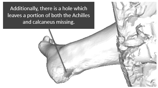 OHI1Scan Troubleshooting Support